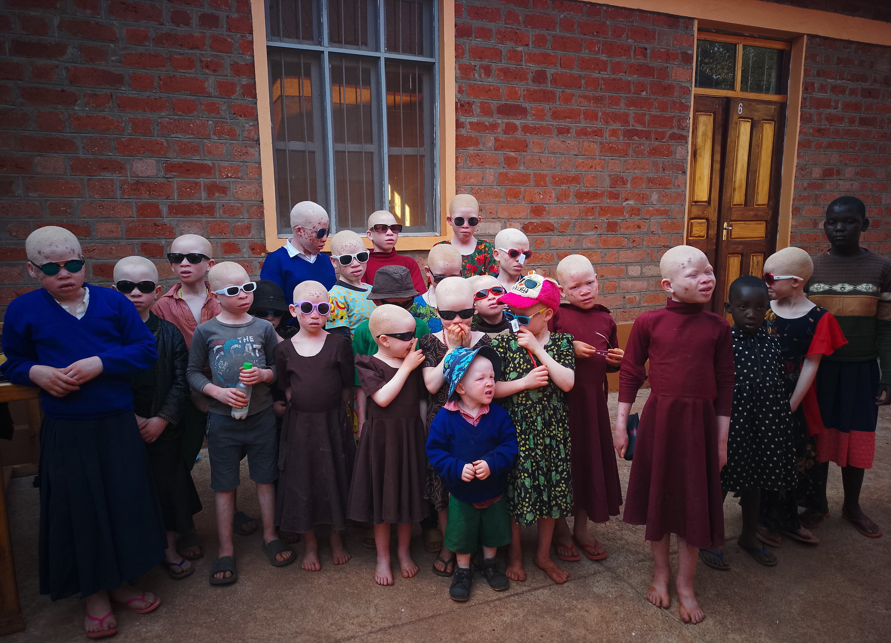 Kinder mit Albinismus in Tansania